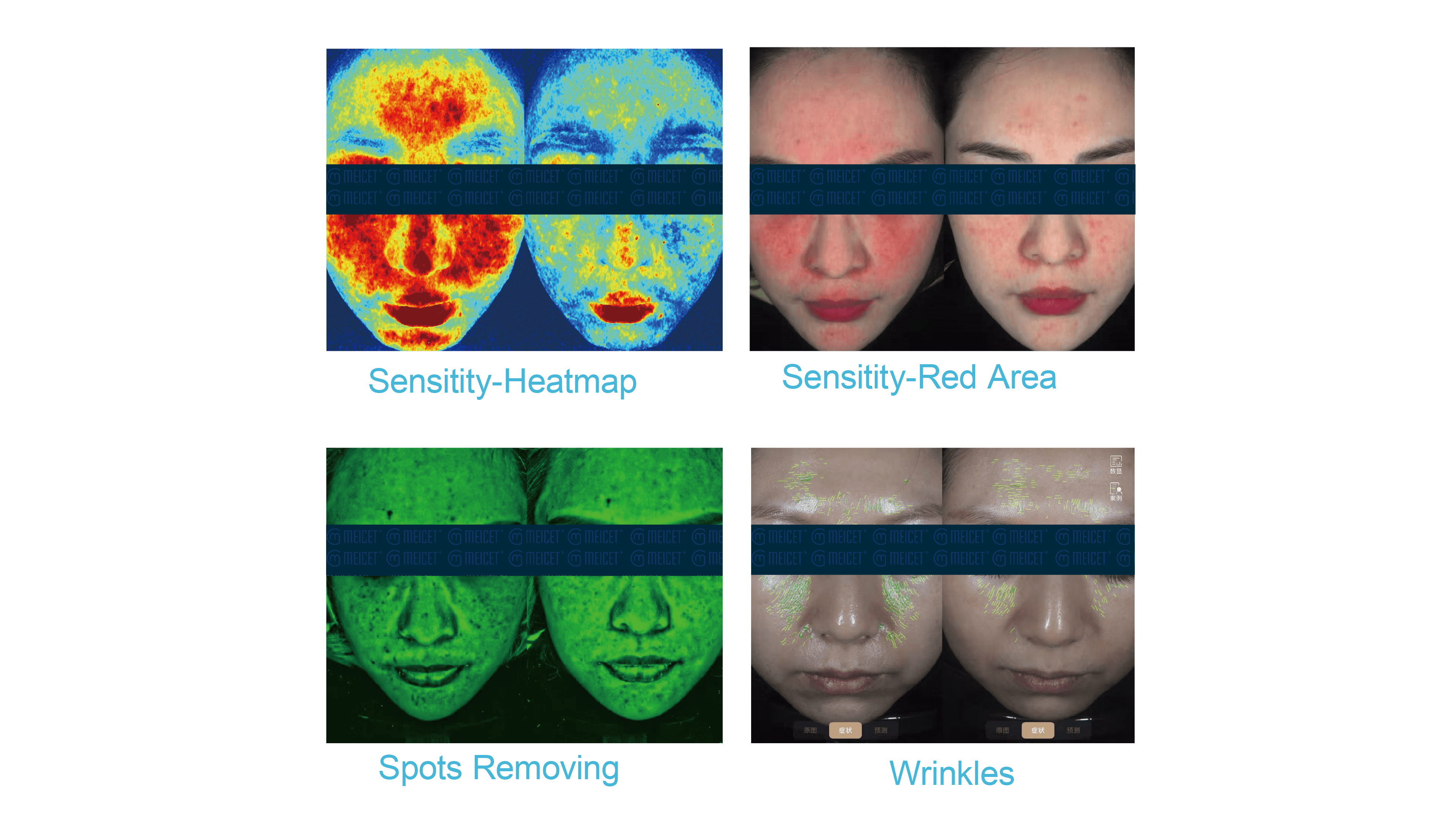 Meicet | China MEICET MC10 Facial Skin Analyzer Machine Manufacture and ...