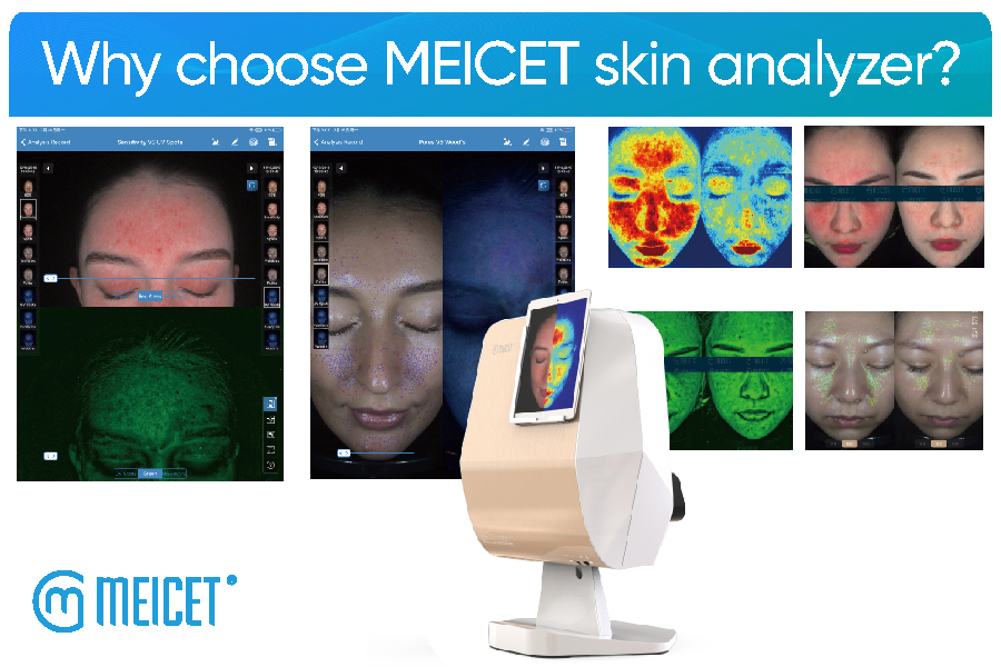 Meicet - Skin Analyzer, Body Analyzer, Beauty Equipment