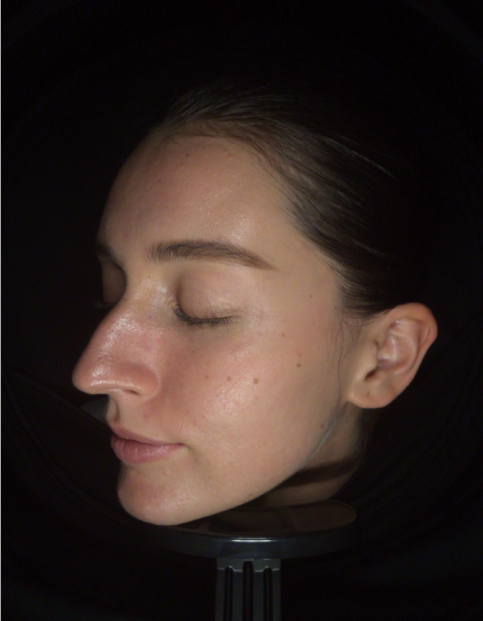 Meicet | China MEICET MC10 Facial Skin Analyzer Machine Manufacture and ...