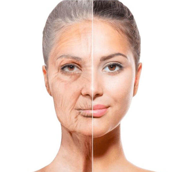 News - Where does facial aging begin?Professional Facial Aging Grading ...