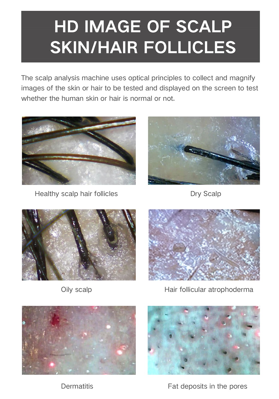 Meicet | China Scalp Analyser Hair Follicle Analysis Machine Meicet ...