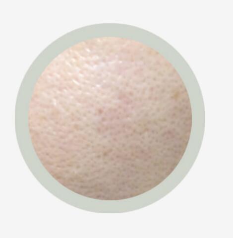 News - Causes of coarse pores