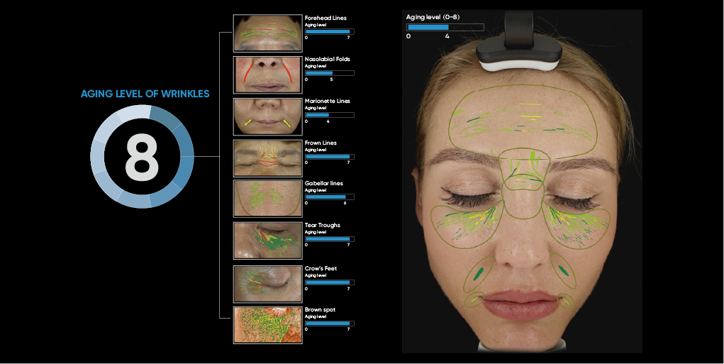 News - ISEMECO 3D D9 Skin Image Analyzer New Product Release，Skin ...