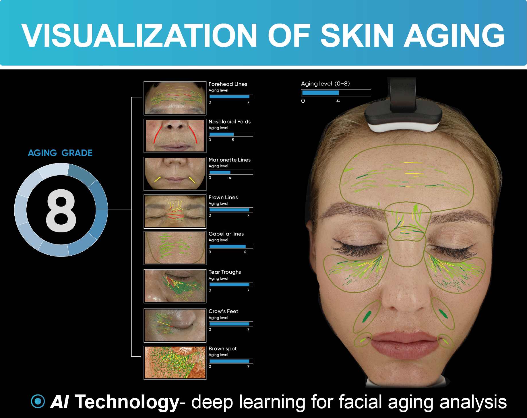 News - ISEMECO 3D D9 Skin Image Analyzer New Product Release，Skin ...