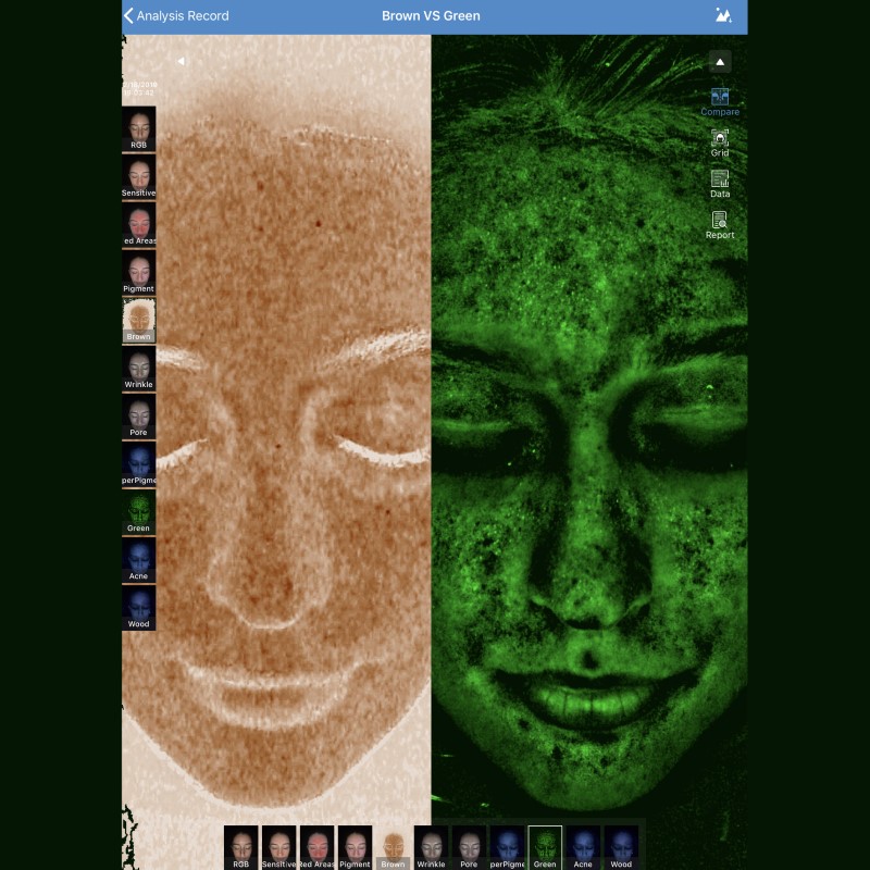 Meicet | China Full Face Scan Dermatoscope Intelligent Skin Analyzer ...