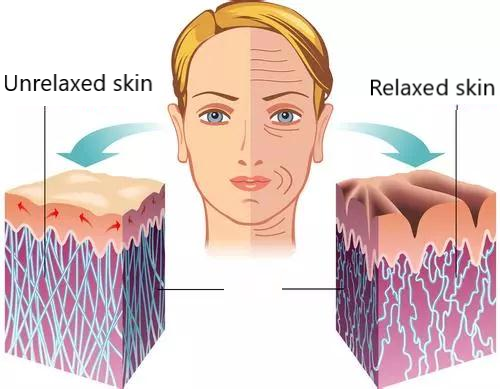 News - Cause analysis: Causes of skin aging——Why is the skin loose?